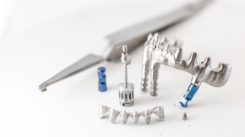 Impression Die Forging Advantages | Strength & Precision